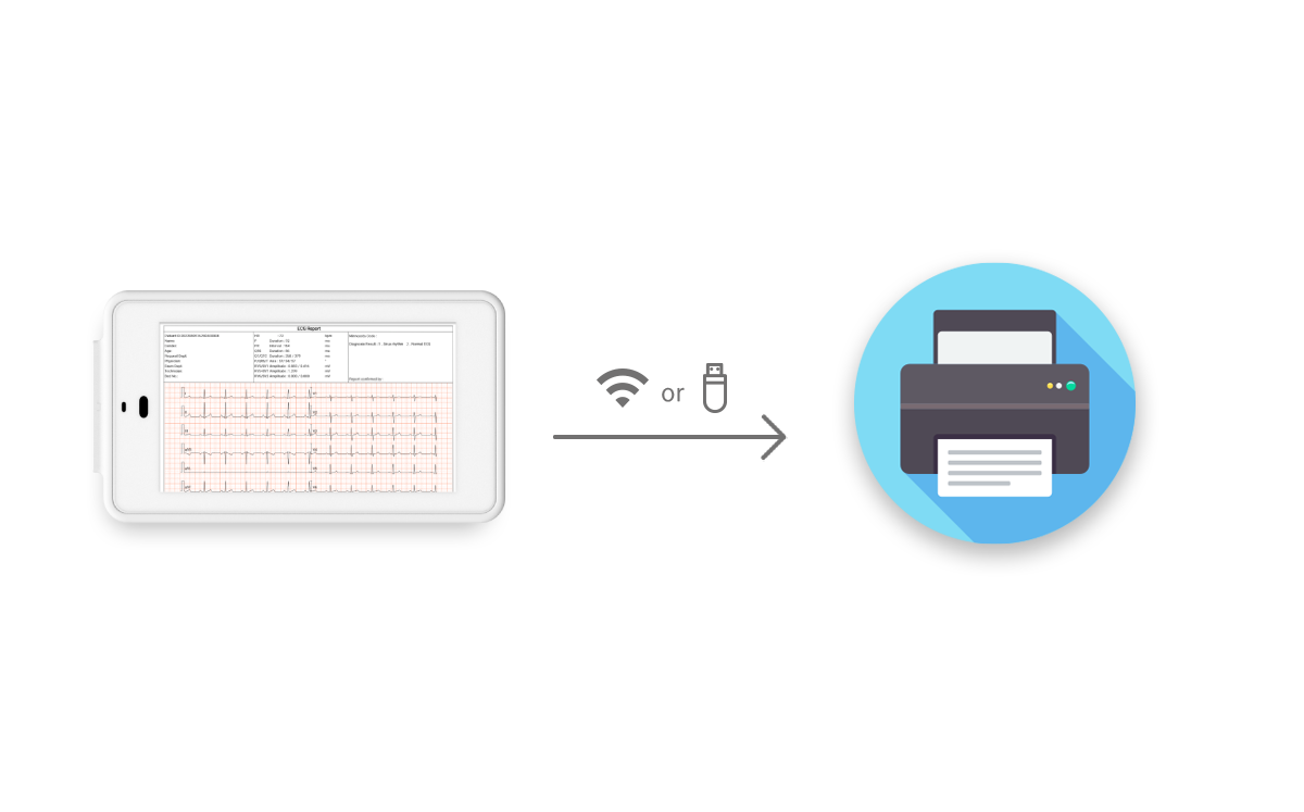Mobile 6/12-Lead EKG/ECG Machine Fits into Your Pocket, with Auto Interpretation, Wirelessly ...